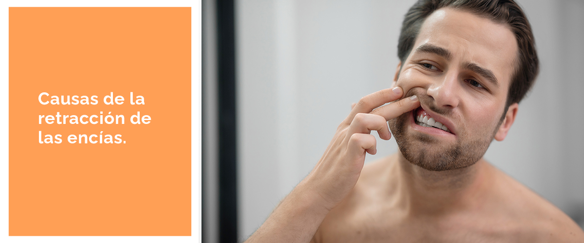 Causas de la retracción de las encías - Clínica dental IOM