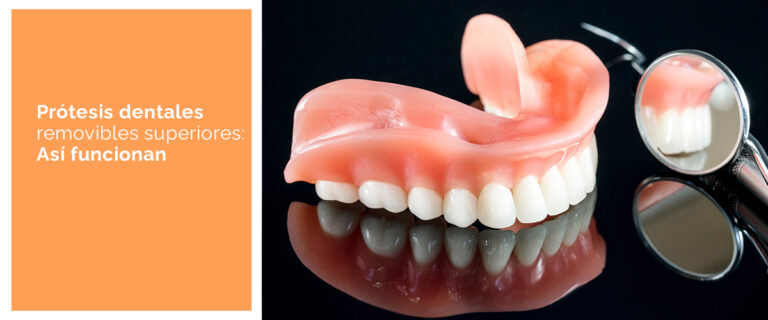 Prótesis dentales removibles superiores: Así funcionan - Clínica dental IOM