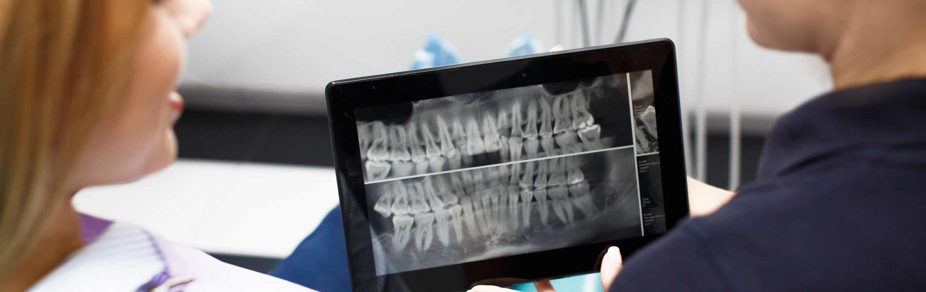 TAC Dental 3D TAC Dental 3D